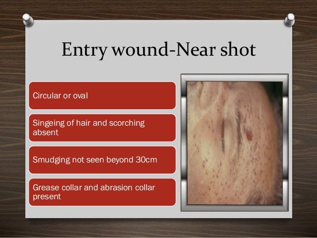 Firearm injuries_Forensics