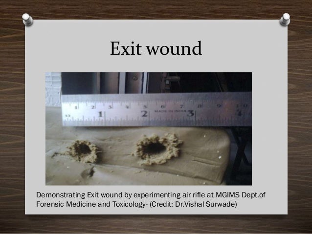 Firearm injuries_Forensics