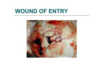 Fire arm injuries | PPT