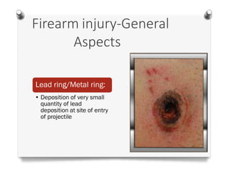 Firearminjuries | PDF