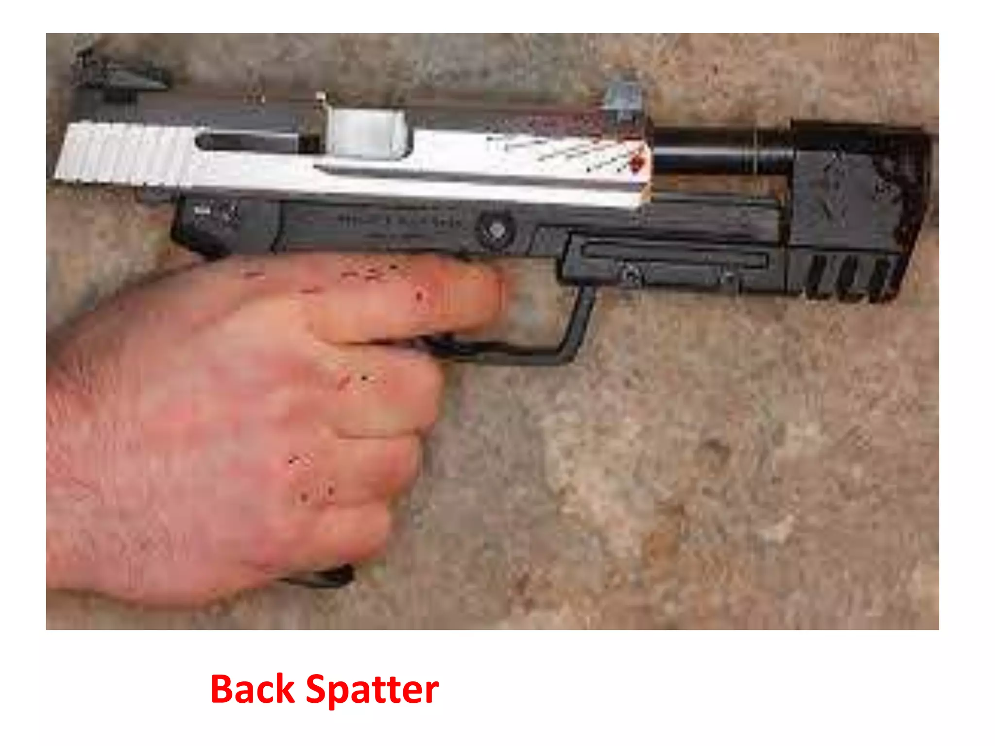 Firearm injuries | PPTX