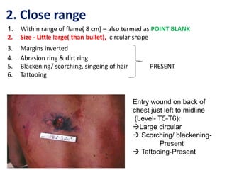 Firearm injuries | PPTX