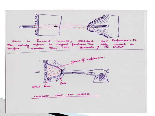 FIREARM INJURIES.pptx forensic medicine h | PPTX