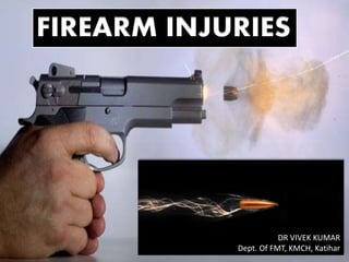 Post Mortem Ballistic