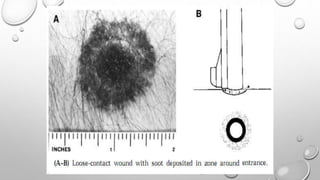 Firearm injuries | PPTX