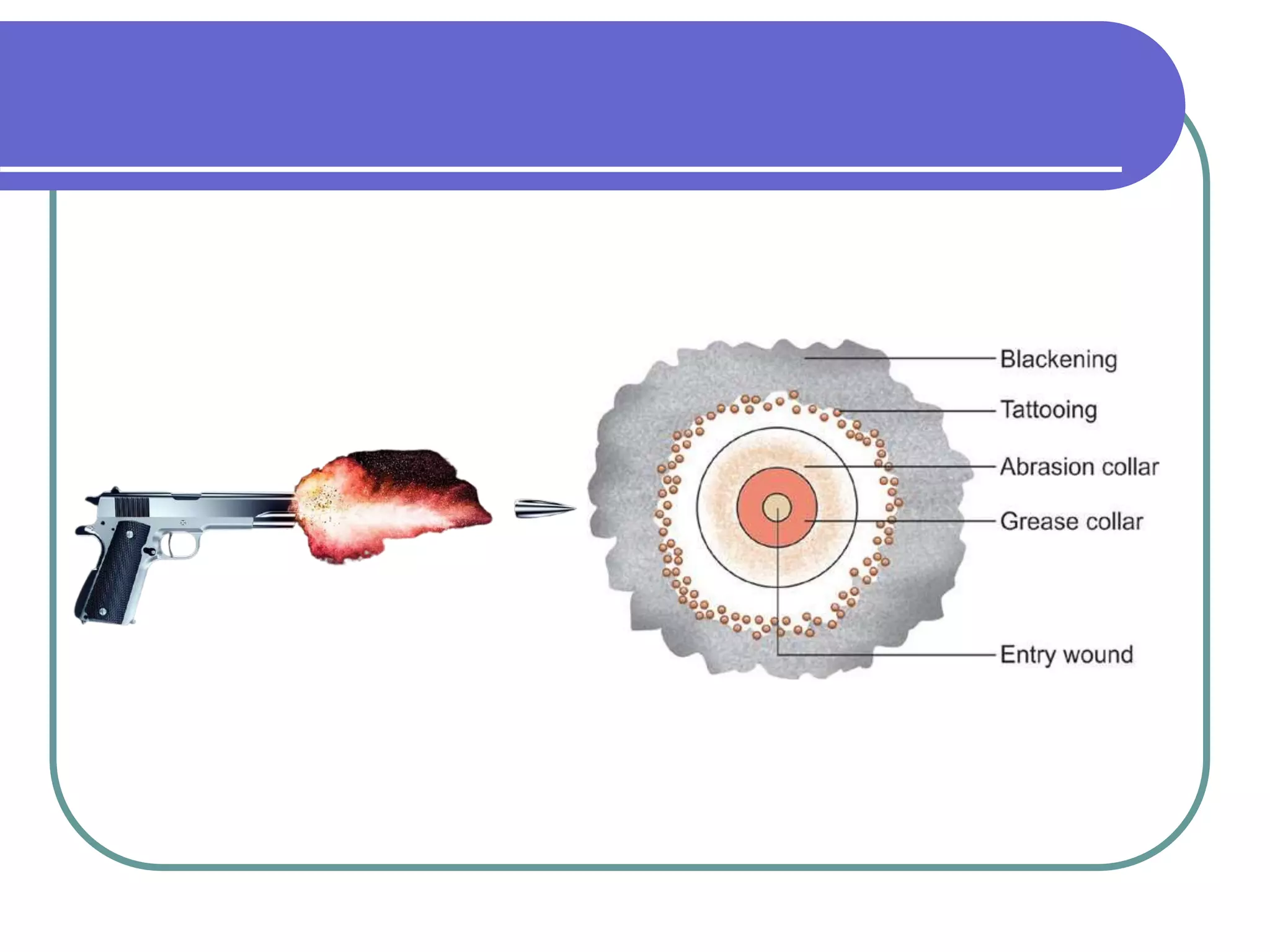 Firearm injuries - Forensic Aspects | PPT