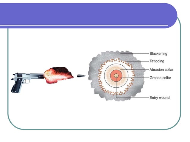 Firearm injuries - Forensic Aspects | PPT