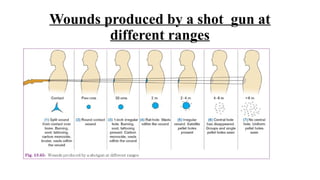 FIRE ARMS AND WOUND BALLISTICS- FORENSIC OVERVIEW | PPTX