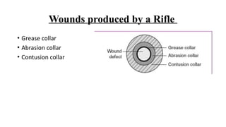 FIRE ARMS AND WOUND BALLISTICS- FORENSIC OVERVIEW | PPTX