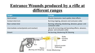 FIRE ARMS AND WOUND BALLISTICS- FORENSIC OVERVIEW | PPTX