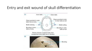 FIRE ARMS AND WOUND BALLISTICS- FORENSIC OVERVIEW | PPTX