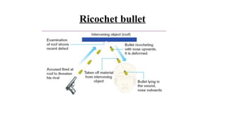 FIRE ARMS AND WOUND BALLISTICS- FORENSIC OVERVIEW | PPTX