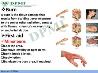 First aid | PPT