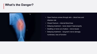 First-Aid-Fractures in healthy care | PPT