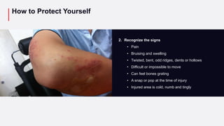 First-Aid-Fractures in healthy care | PPT