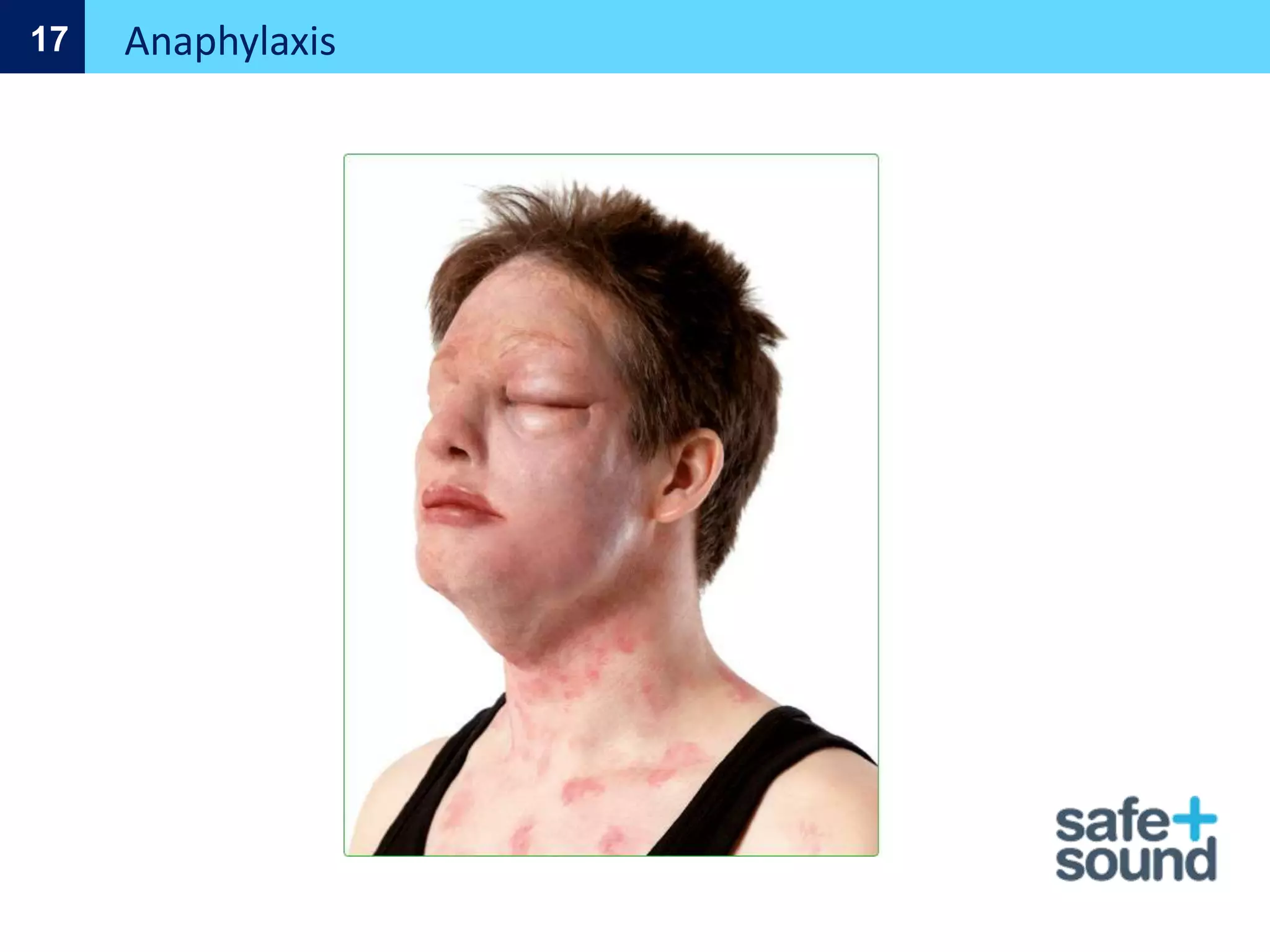 First-Aid-Made-Easy-Training-Presentation (1).pptx