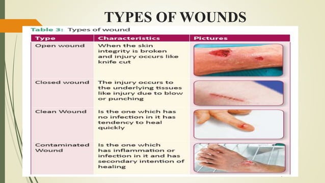 First-aid & Emergencies.pptx | First Aid | Injuries