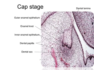 First trimester-in-oral-histology-projections-slides-dr.-nada | PPT