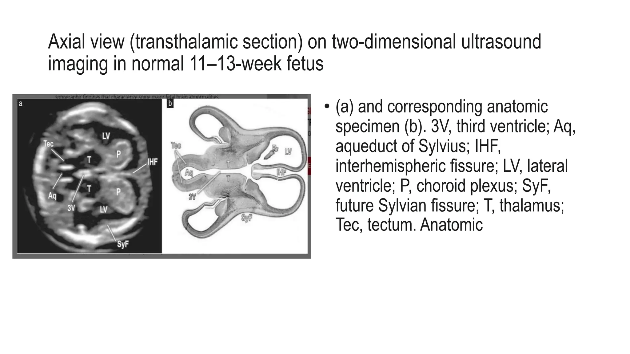 First-trimester fetal neurosonography-DR.BAHRİ.pptx