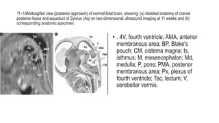 First-trimester fetal neurosonography-DR.BAHRİ.pptx