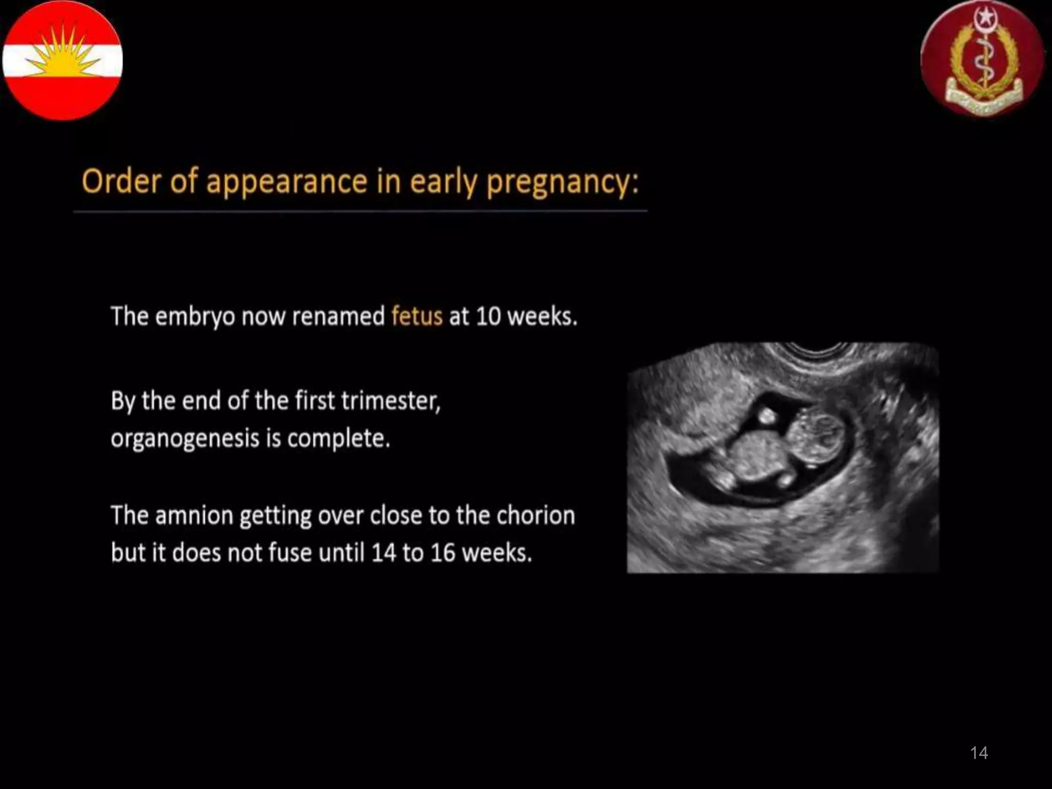 First trimester ultrasound.pptx