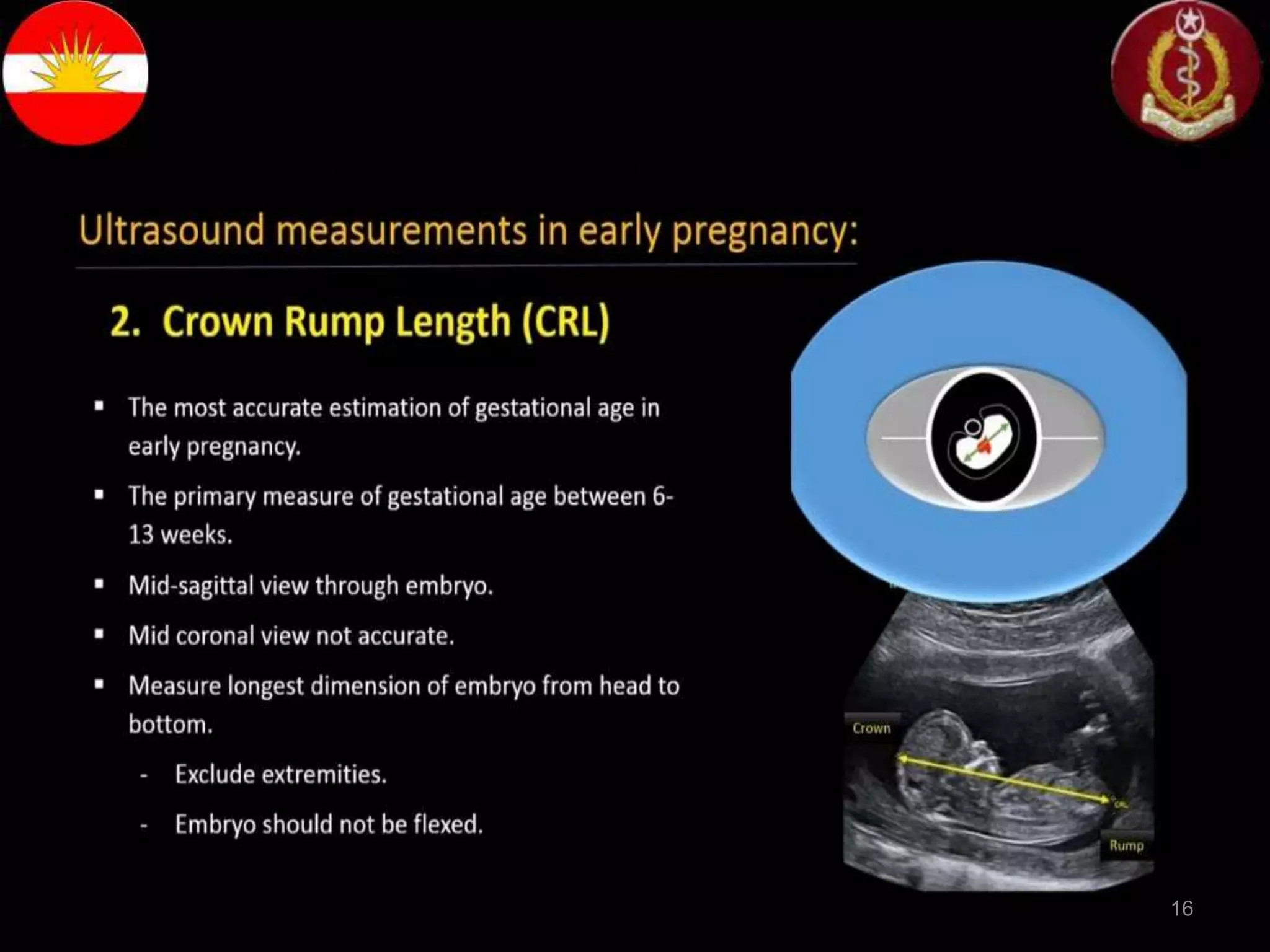 First trimester ultrasound.pptx