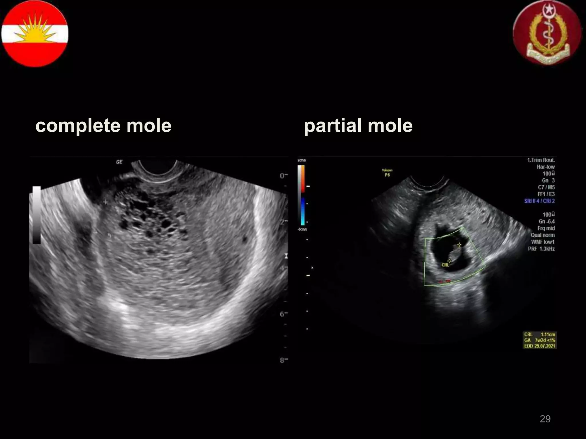First trimester ultrasound.pptx
