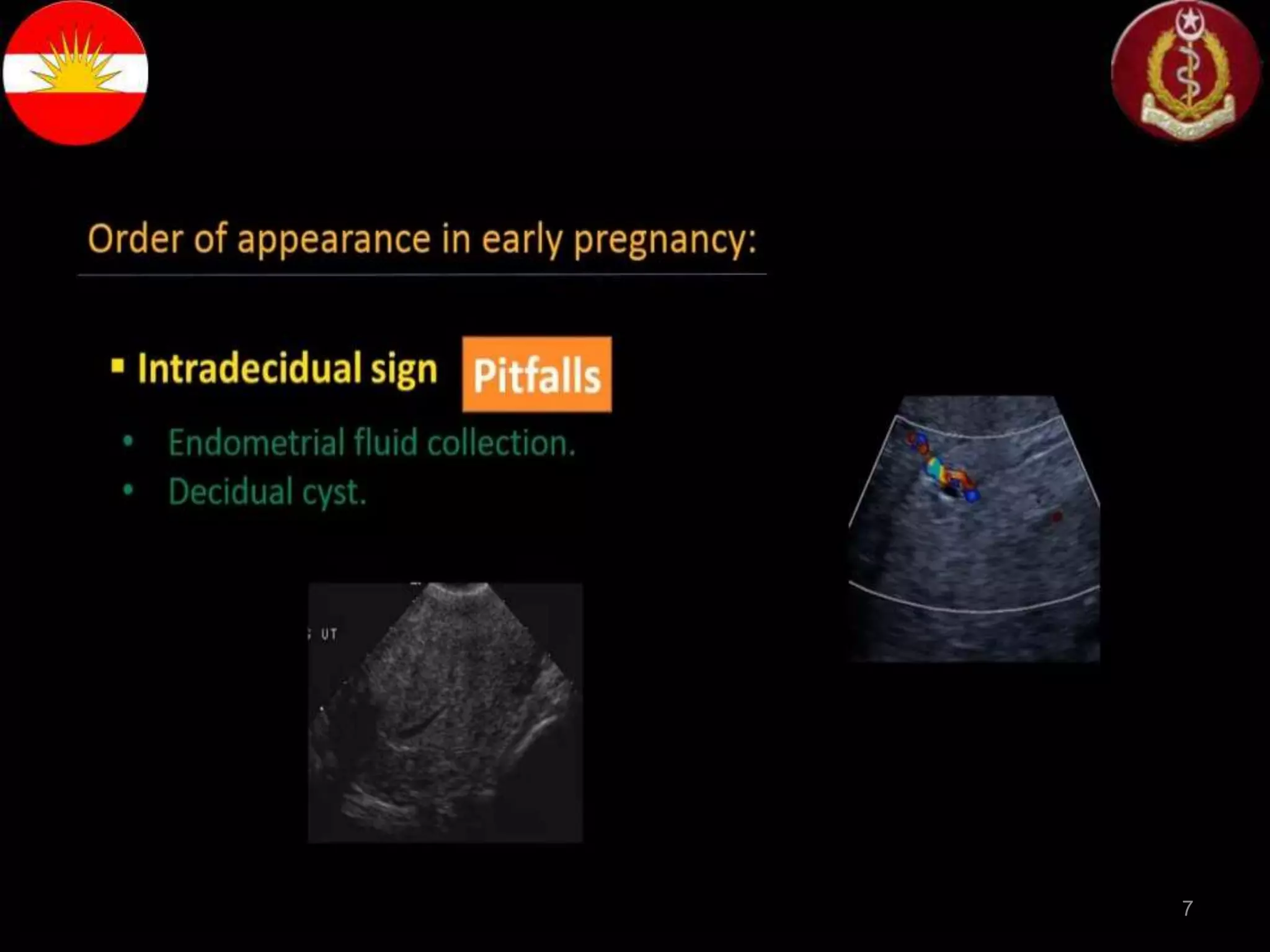 First trimester ultrasound.pptx