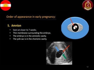 First trimester ultrasound.pptx