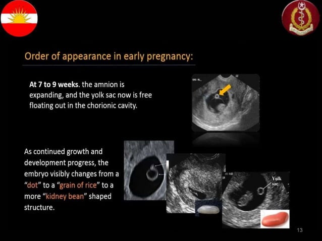 First trimester ultrasound.pptx