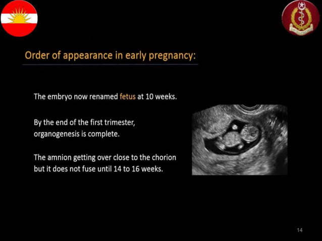 First trimester ultrasound.pptx