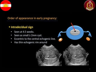 First trimester ultrasound.pptx