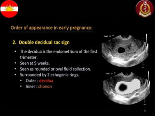First trimester ultrasound.pptx