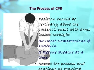 Basic First Aid | PPT