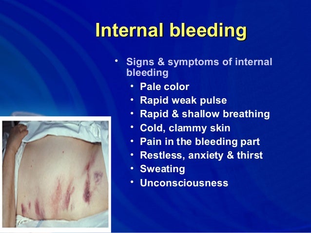 Signs of abdominal bleeding from trauma - leisuredolf