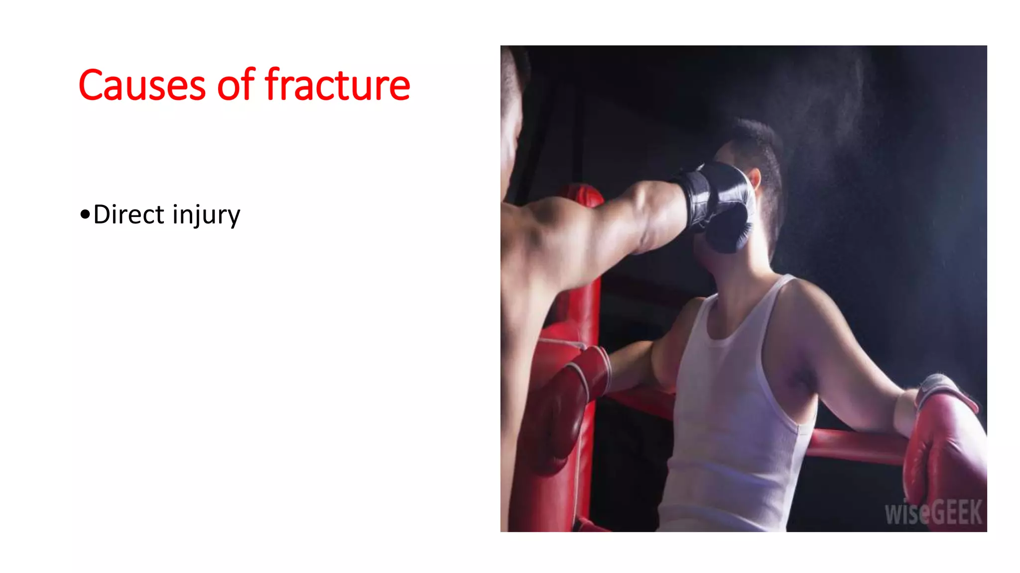 Fracture first aid by Dr. Hany Aldakar MD. Orthopedic Surgery and ...