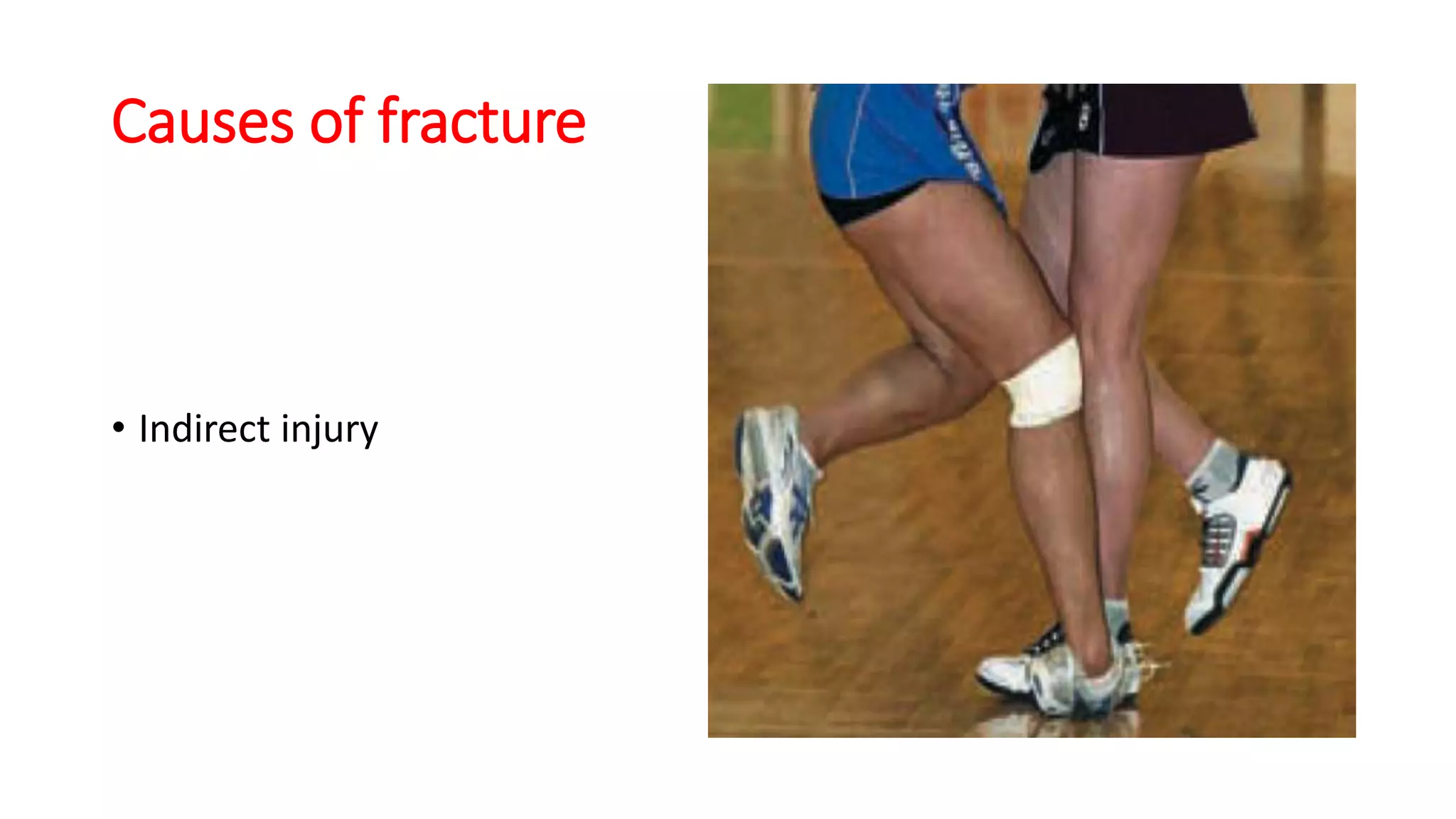 Fracture first aid by Dr. Hany Aldakar MD. Orthopedic Surgery and ...