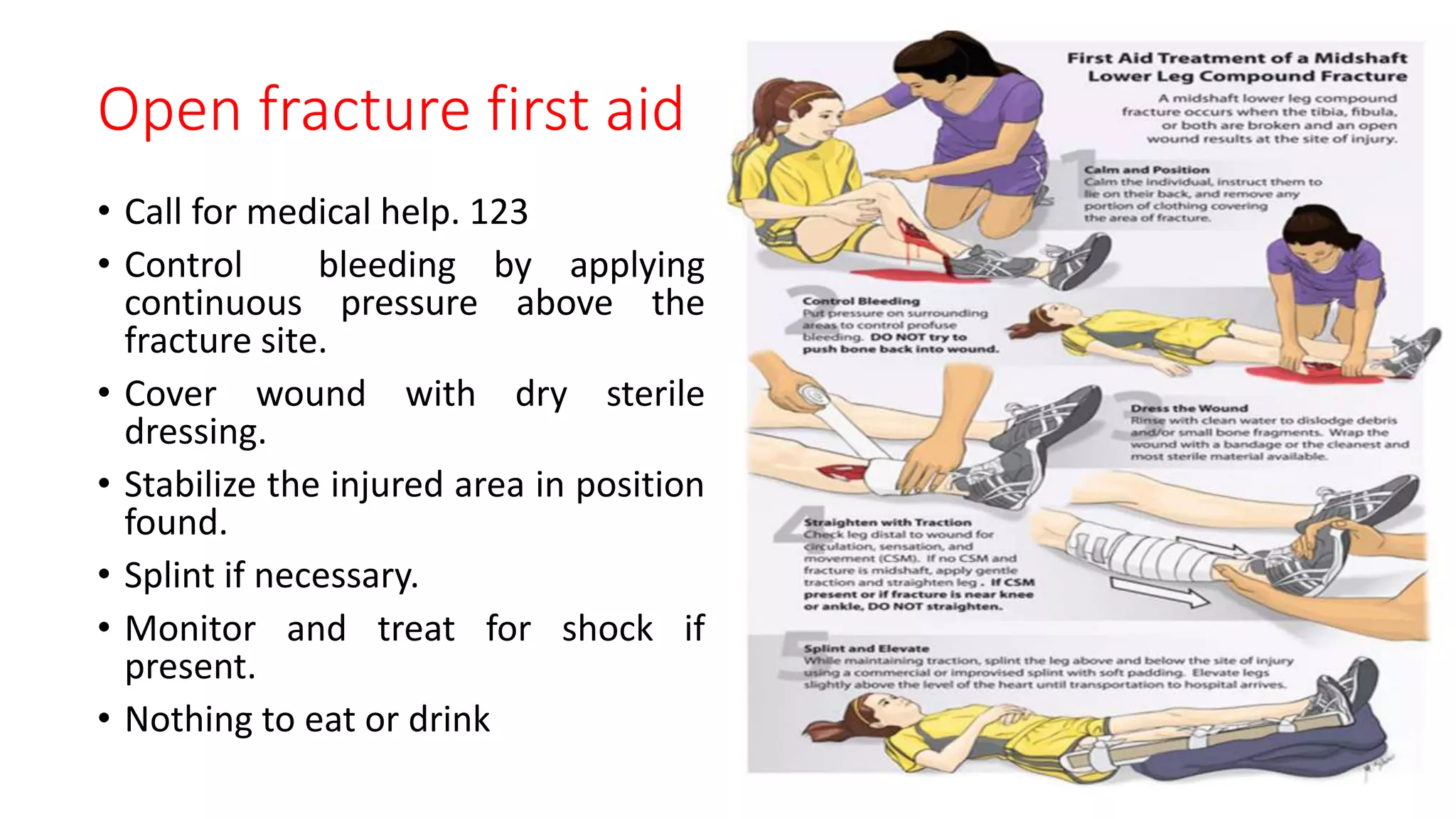 Fracture first aid by Dr. Hany Aldakar MD. Orthopedic Surgery and Traumatology | PPTX