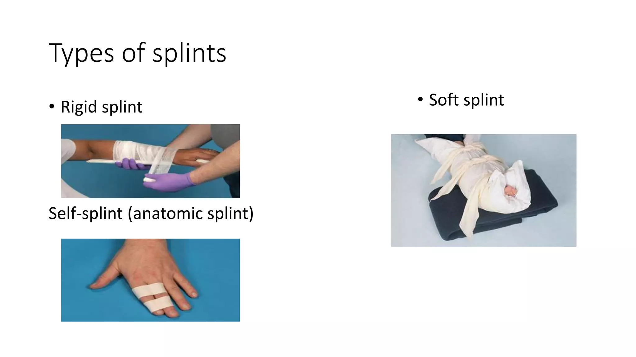 Fracture first aid by Dr. Hany Aldakar MD. Orthopedic Surgery and ...