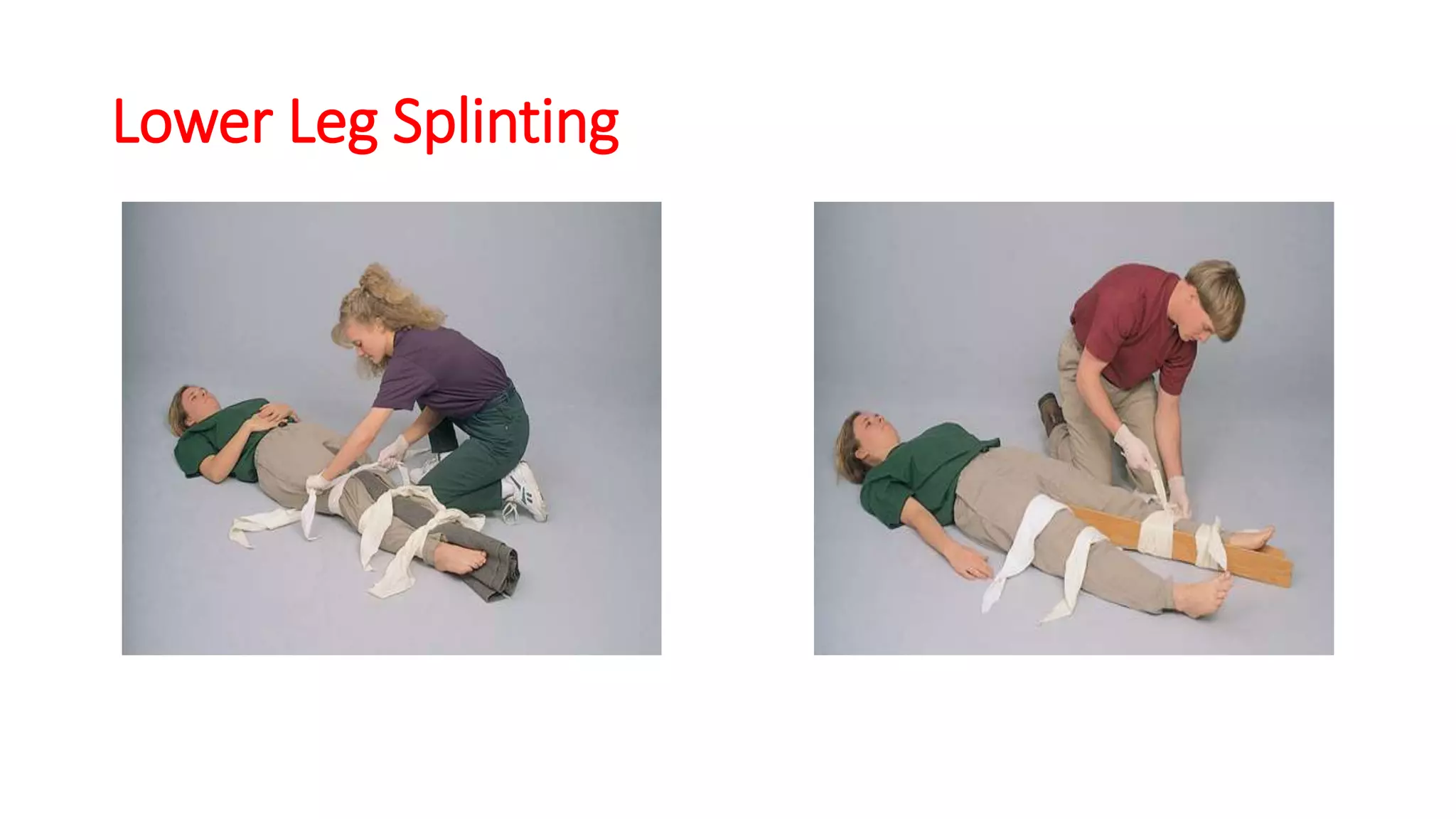 Fracture first aid by Dr. Hany Aldakar MD. Orthopedic Surgery and ...