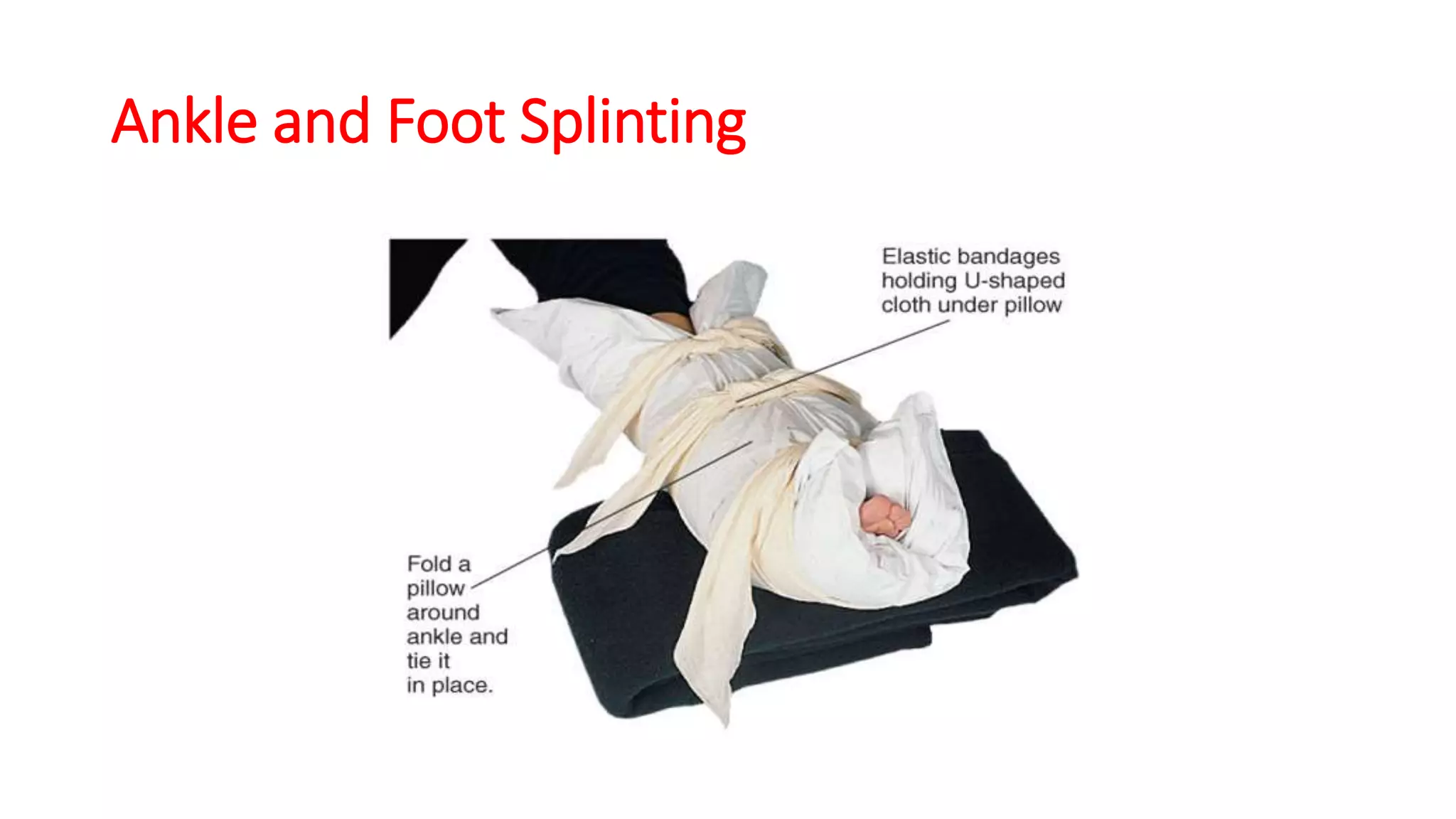 Fracture first aid by Dr. Hany Aldakar MD. Orthopedic Surgery and ...