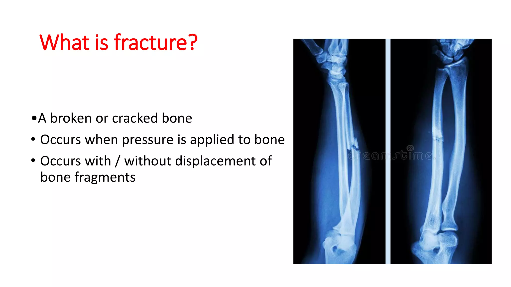 Fracture first aid by Dr. Hany Aldakar MD. Orthopedic Surgery and ...