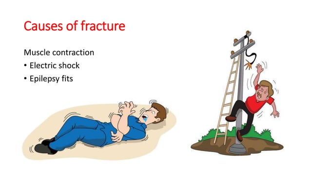 Fracture first aid by Dr. Hany Aldakar MD. Orthopedic Surgery and ...