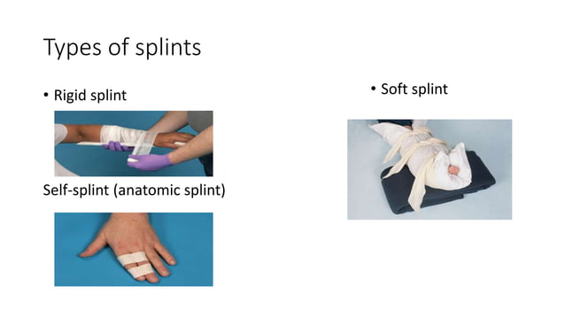 Fracture first aid by Dr. Hany Aldakar MD. Orthopedic Surgery and ...