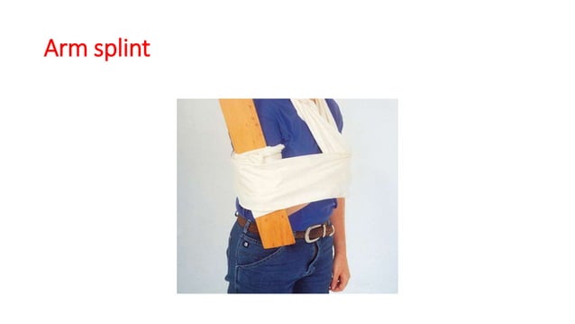 Fracture first aid by Dr. Hany Aldakar MD. Orthopedic Surgery and ...