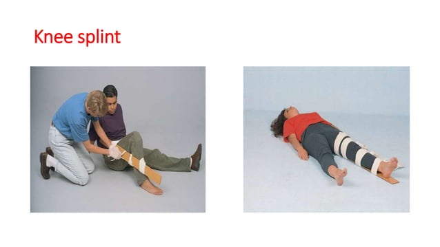 Fracture first aid by Dr. Hany Aldakar MD. Orthopedic Surgery and ...