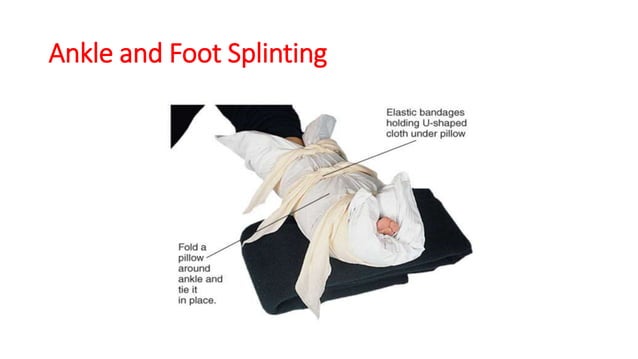 Fracture first aid by Dr. Hany Aldakar MD. Orthopedic Surgery and ...
