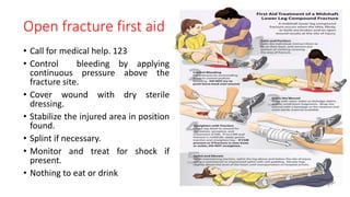 First Aid Pictures For Fractures