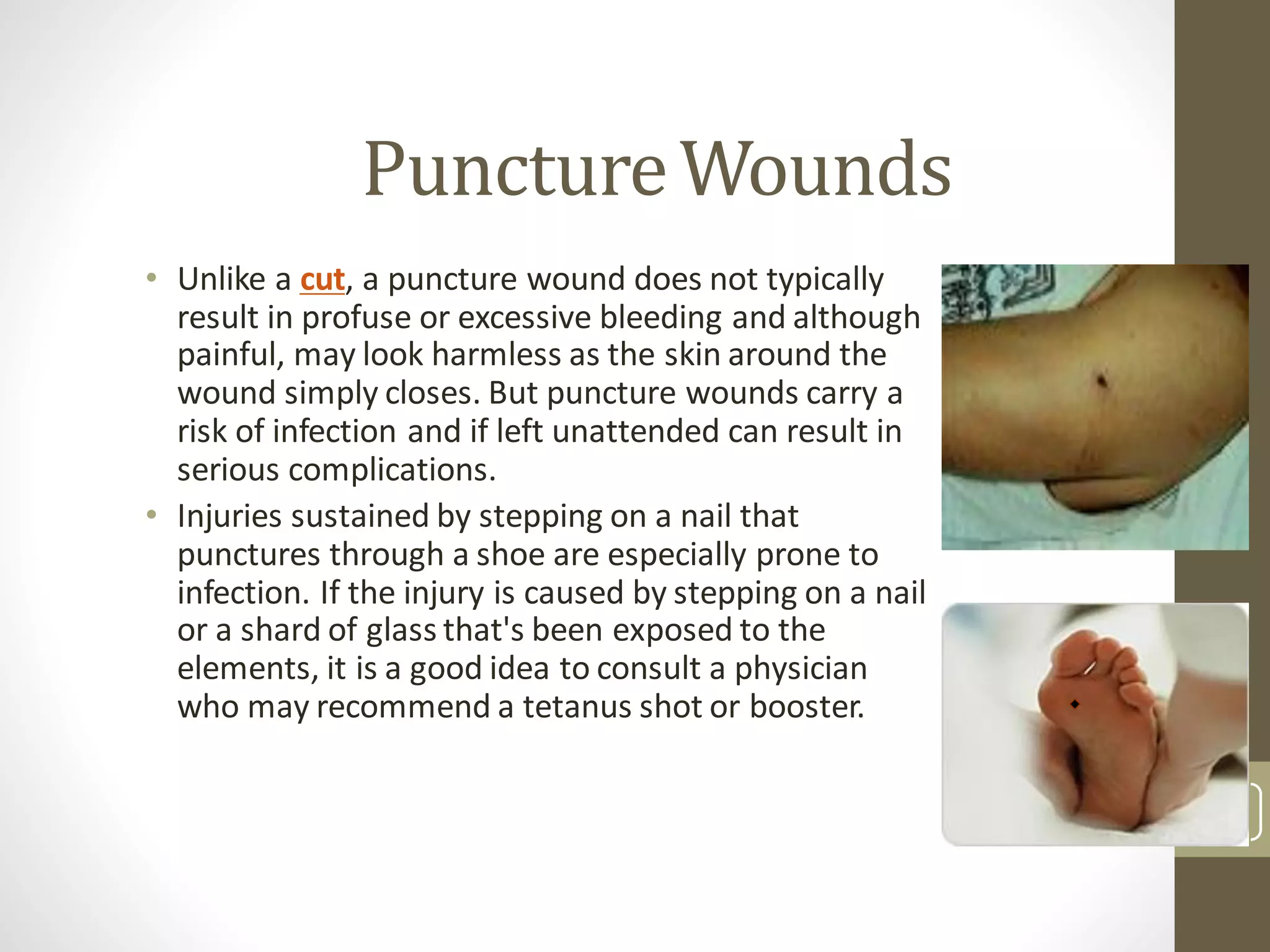 First Aid I First Aid Training I HSE Presentation | Gaurav Singh Rajput ...