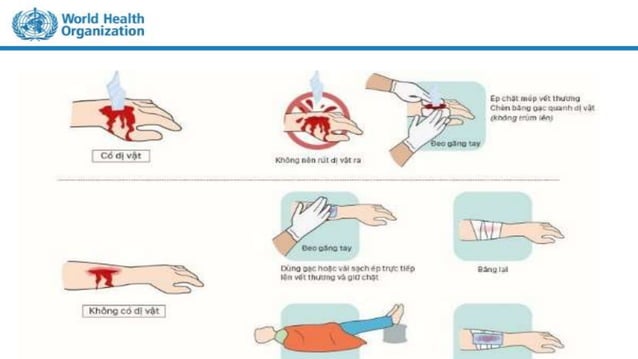 SƠ CẤP CỨU CHẤN THƯƠNG First Aid.pptx